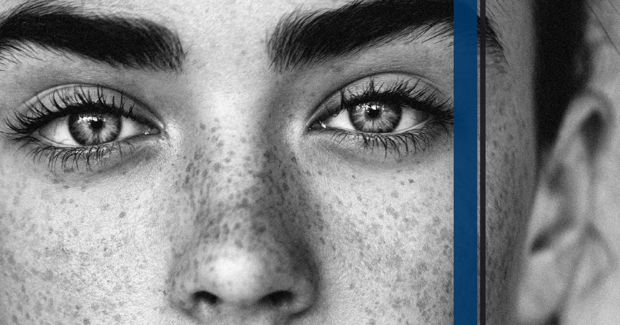 Ohrenkorrektur - Dr. Doris Spreitzer